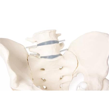 Pelvis masculina con sacro, 2 vértebras lumbares y fémur